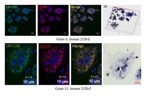 The Phagocytic Receptor Cd35 On The Cells In The Fragments Of Mouse