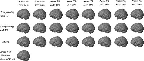 sample slice from the brain phantom segmentation experiment a