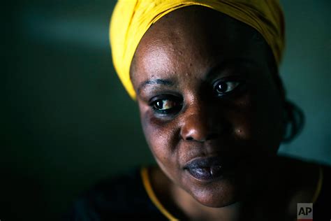 Un Mission In Congo Forces Reckoning Over Sex Abuse Scandal — Ap Photos