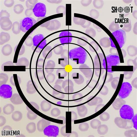 Leukemia Begins In A Cell In The Bone Marrow The Cell Undergoes A