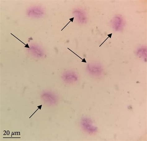 Dna Fragmentation In Rat Sperm A Fragmented Sperm Dna And B