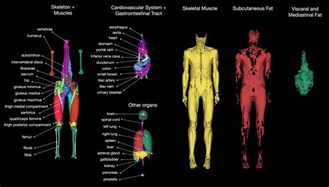 Totalsegmentator For Mri Dataset Support 3d Slicer Community