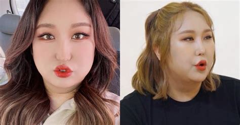 나는 정통으로 맞았다 트렌스젠더 풍자 성전환 수술 부작용 고백했다 위키트리