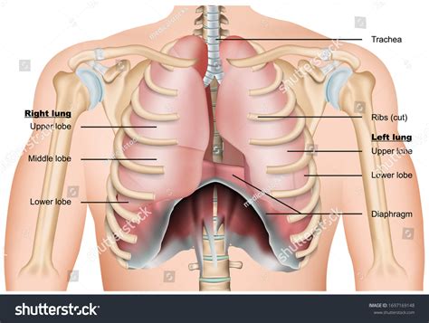 Images In Thorax The Radiology Assistant Chest X Ray Nrgu