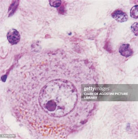 Ganglion Cells Photos And Premium High Res Pictures Getty Images