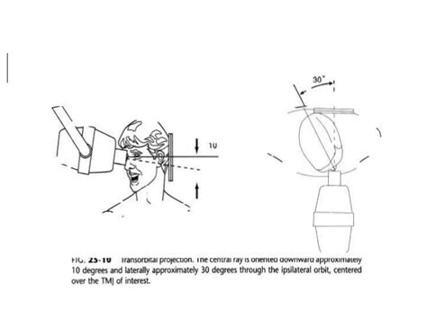 Tmj Examination And Imaging Pptx