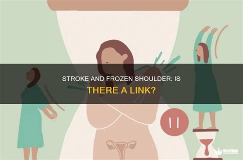 Stroke And Frozen Shoulder Is There A Link Medshun