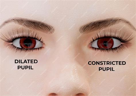 Premium Photo Miosis Is A Condition In Which One Or Both Pupils