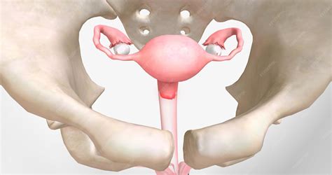 Premium Photo Chlamydia Is A Sexually Transmitted Infection Caused By Chlamydia Trachomatis