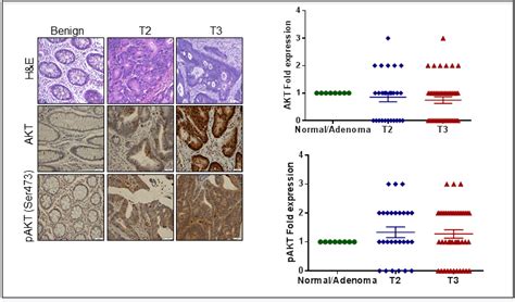 Histological Analysis Of Crc Human Tissue Microarray Tma A H And E