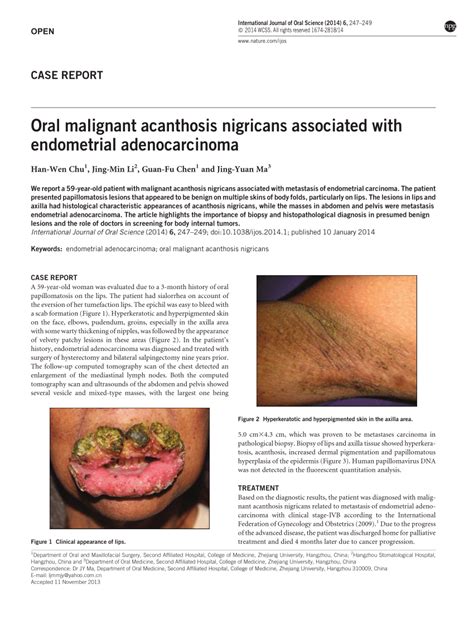 Pdf Oral Malignant Acanthosis Nigricans Associated With Endometrial