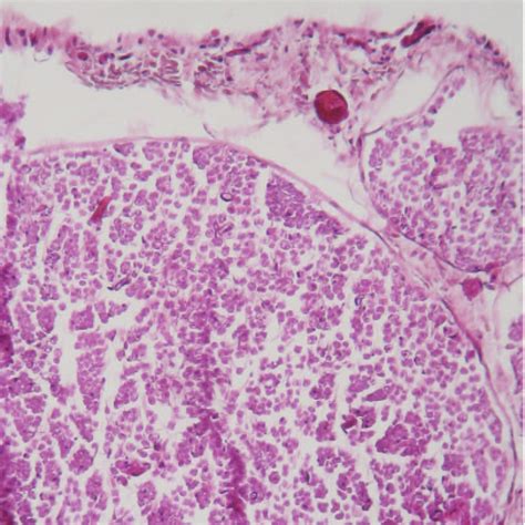 Transverse Section Of The Rat Sciatic Nerve After 7 Days Of Reperfusion