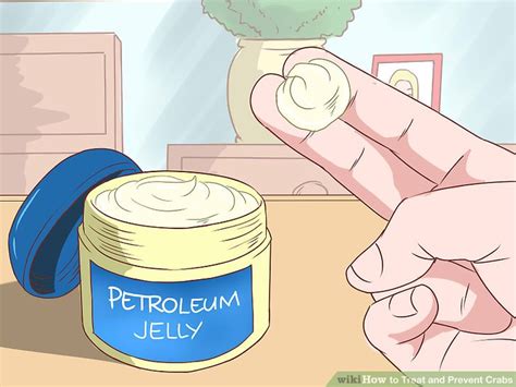 4 Ways To Treat And Prevent Crabs WikiHow