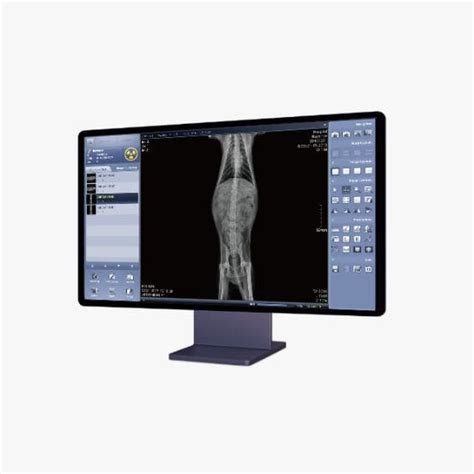 Viewer Software Vxv Console Rayence Diagnostic Acquisition Measurement