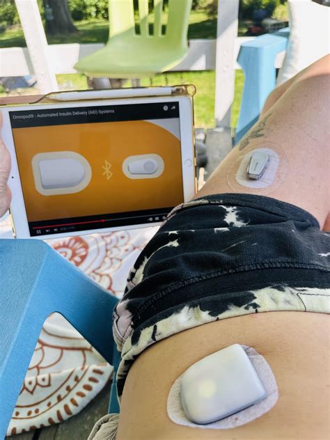 Broke Up With T Slim Today R Omnipod