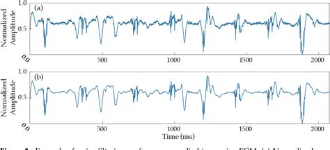 Figure 2 From An Efficient Hybrid Methodology For Local Activation Waves Detection Under Complex