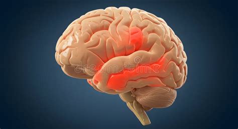 3d Render Of Human Brain With Highlighted Temporal Lobe Indicating Epilepsy Or Neurological