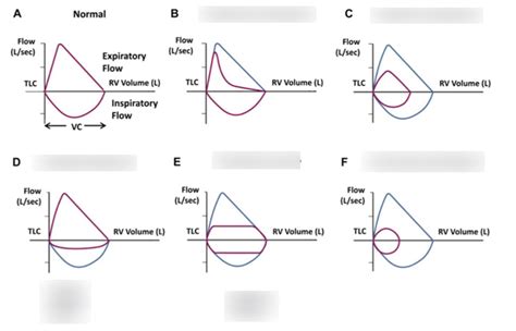Flow Volume Loop Diagram Quizlet
