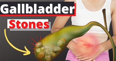 What Is Gallbladder Function Disease And Treatment