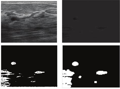 Illustration Of The Operation Of The Three Stages Preprocessing Local Download Scientific