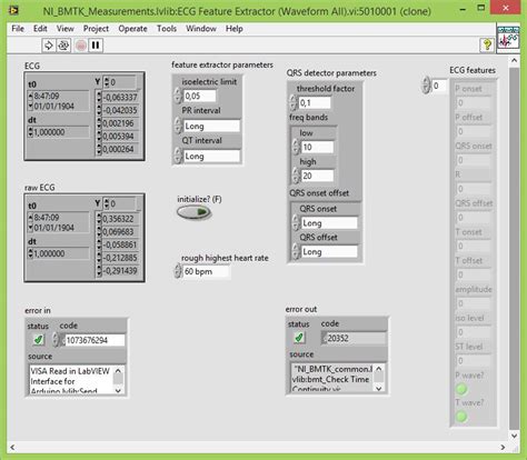 Solved Ecg Feature Extraction Ni Community