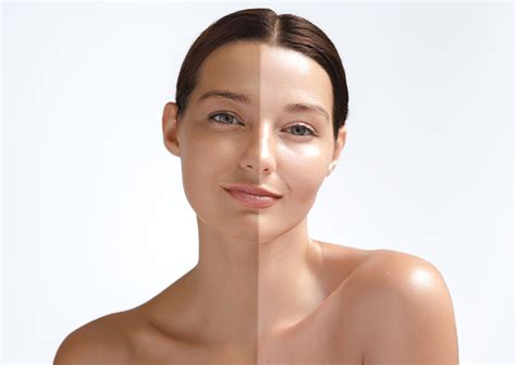 How To Safely Tan With Fair Skin In 10 Steps Quicktan