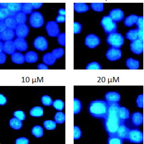 Dapi Staining Showing The Effects Of Baicalein On The Induction Of Download Scientific Diagram