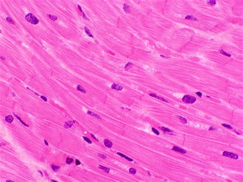 Myocardium Tissue