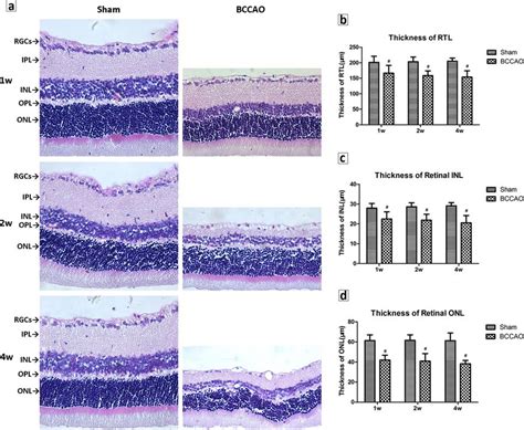 Retinal Histology And Morphology In He The Magnification Of Retinal