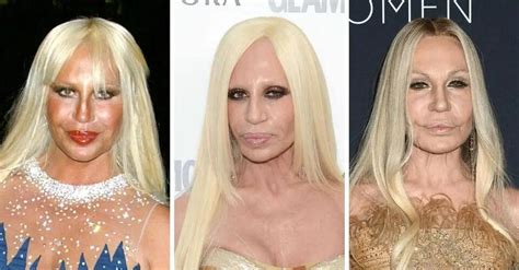 Donatella Versaces Wild Transformation Revealed See How Much The