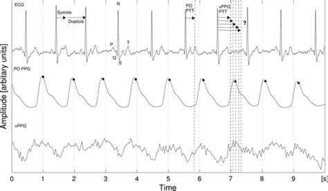 Relationship Between Ecg Po Ppg And Vppg Signals Typical Fiducial Download Scientific Diagram