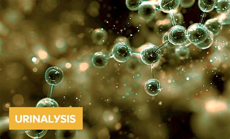 Science Of Urinalysis Urothelial Cells
