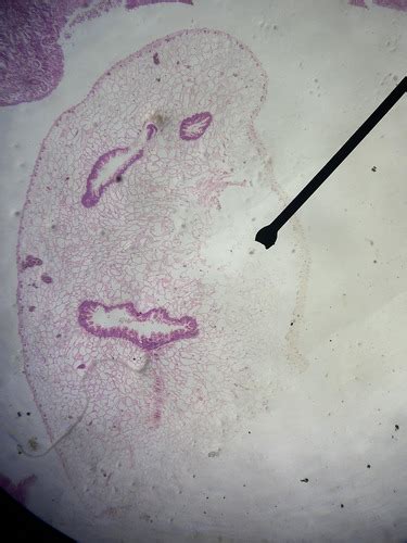 Trematodes Identification Flashcards Quizlet