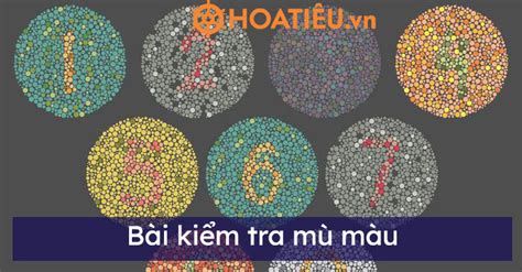 3 Bài Kiểm Tra Mù Màu 2026 Chuẩn Nhất Cách Kiểm Tra Mù Màu