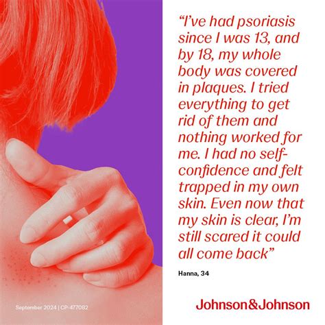 Jandj Innovative Medicine Europe Middle East And Africa Emea On Linkedin