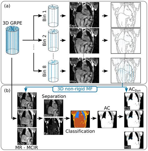 A Mr Motion Estimation The 3d Grpe Data Were Split Into Eight Download Scientific Diagram