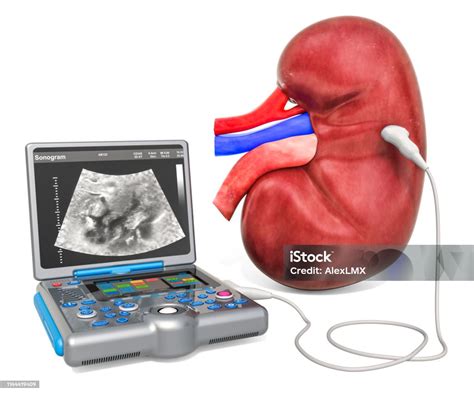 신장 초음파 개념 의학 초음파 진단 기계 백색 배경에 고립 된 3d 렌더링을 가진 인간적 인 신장 약에 대한 스톡 사진 및 기타