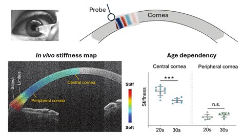 Optical Coherence Elastography Archives Ieee Transactions On Biomedical Engineering Tbme