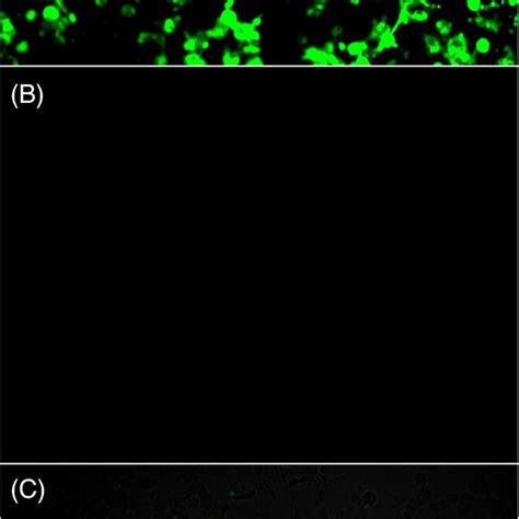 Immunofluorescent Assay Results For The Presence Of Csf Anti‐nmdar1