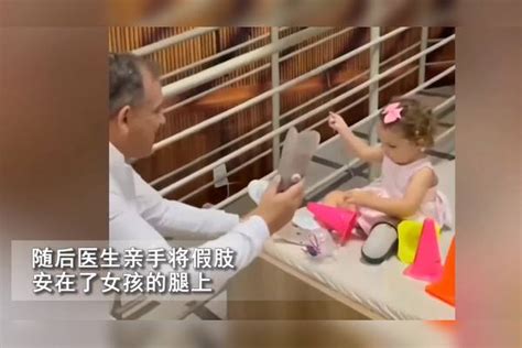 医生拿气球走向截肢女孩，微笑着将假肢安她腿上：心灵被治愈