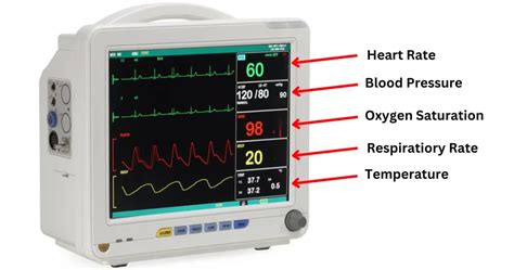 What Is The White Line On A Hospital Monitor
