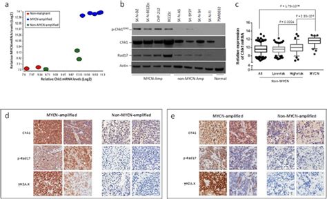 Mycn Amplification Is Associated With High Chk1 Signaling And Rs A