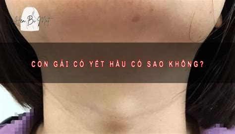 Con Gái Có Yết Hầu Có Sao KhôngCó Nên Cắt Bỏ