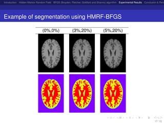 Hidden Markov Random Field Model And Bfgs Algorithm For Brain Image Segmentation Pdf Physics