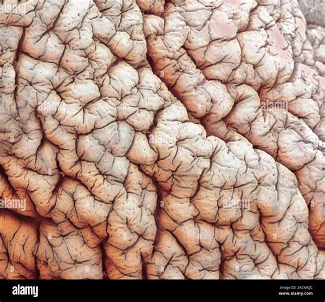 Large Intestine Coloured Scanning Electron Micrograph Sem Of The Mucosa Lining Of The Colon