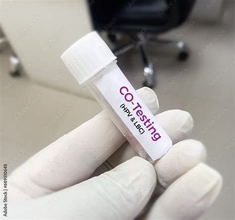 Vaginal Fluid Sample For CO Testing HPV DNA Test And LBC Test Human Papilloma Virus Cervical