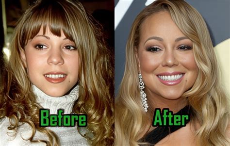 Mariah Careys Transformation Uncovering The Truth Behind Her Plasma
