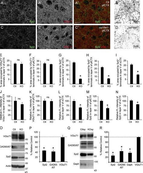 Loss Of Collagen Xix Leads To Impaired Inhibitory Synapse Formation In