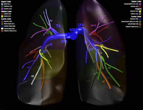 Lung Segments Ct Anatomy Right Lower Lobe Segmentation Cpam In Extra