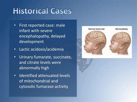 Ppt Fumarase Deficiency Powerpoint Presentation Free Download Id